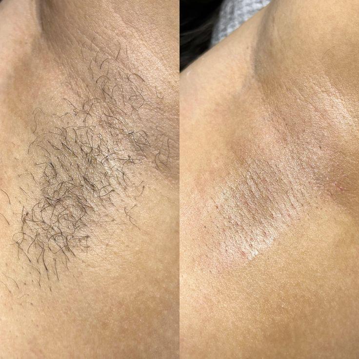 Eyebrow and Full Body Waxing in Wyandotte, MI: Smooth Skin Starts at ...